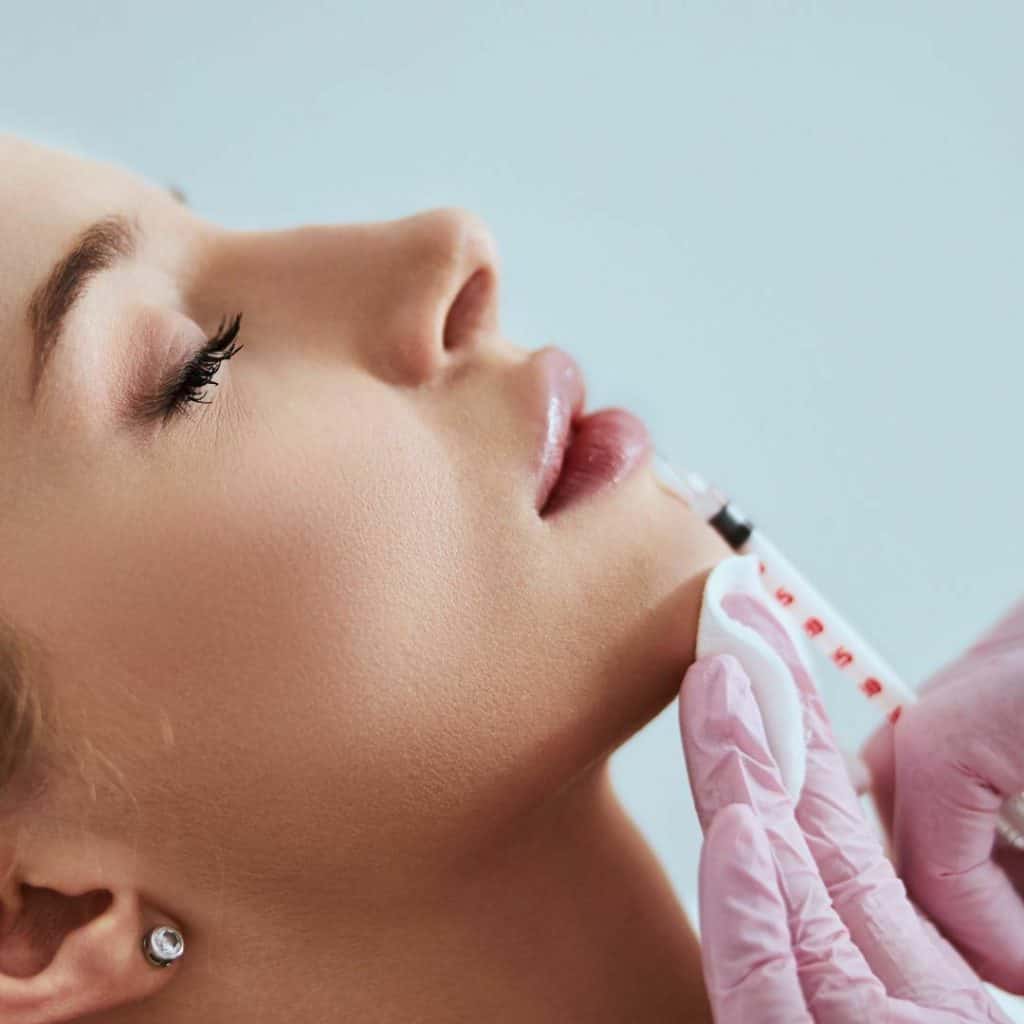 Dermal Filler Vs PDO Thread Lift – Elucell